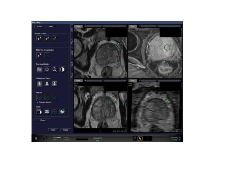 mpMRT-1 - Urologisches Versorgungszentrum Am Krekel Marburg